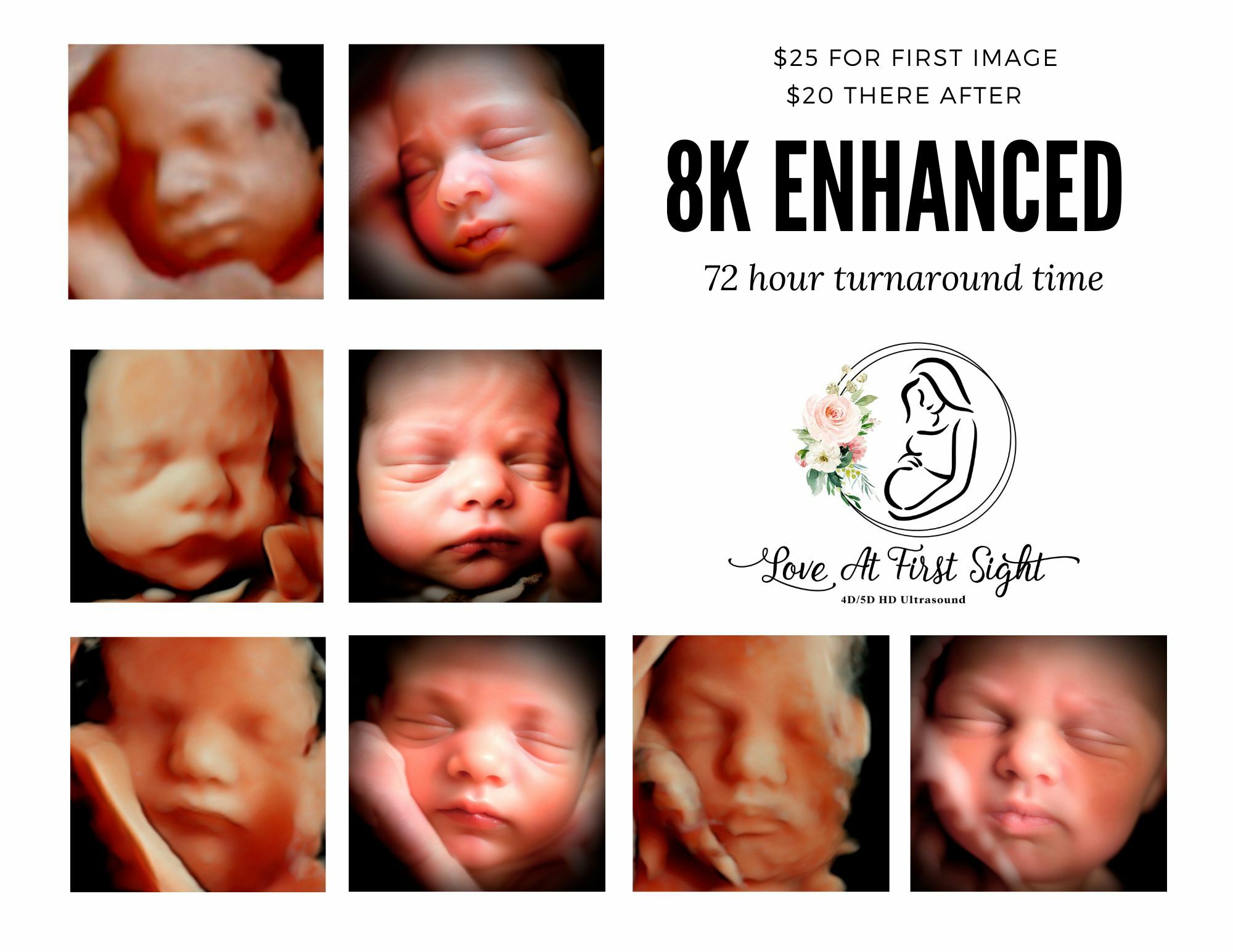 Ultrasound Packages - 3D/4D HD Elective Ultrasound - Gainesville, TX